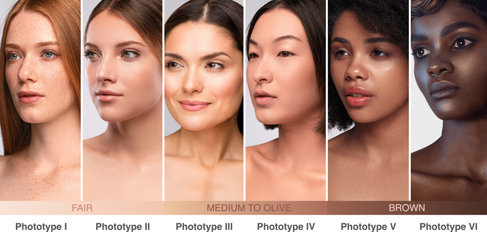 Skin Phototype - Meline